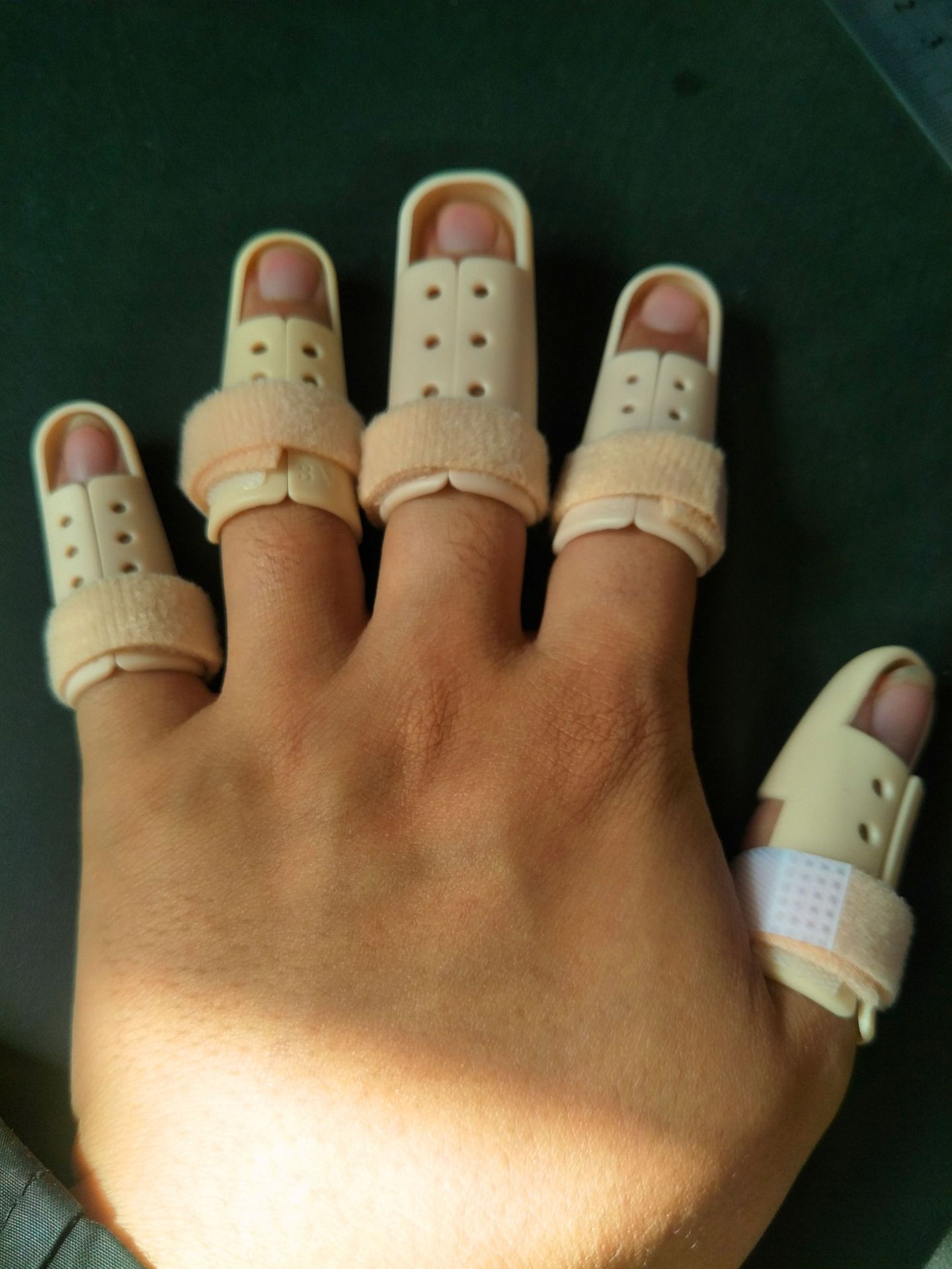 finger clamp finger fixing clip phalanx clip finger fracture sprain ...