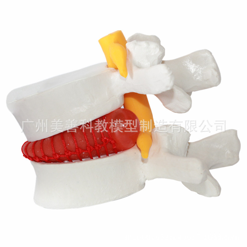 Lumbar model teaching medical human lumbar intervertebral disc ...
