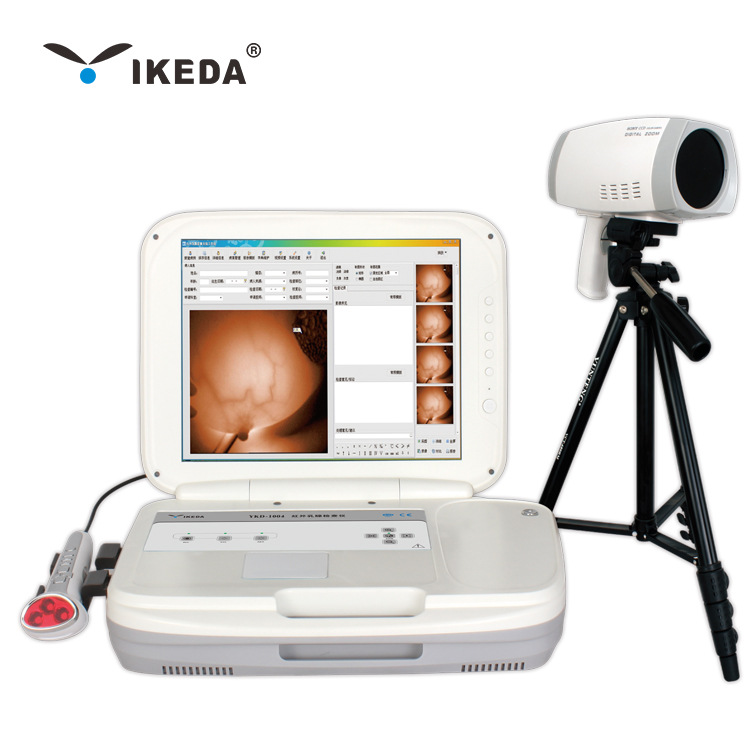 YKD-1004 箱式乳腺检查仪 电脑乳腺检查仪 高清乳腺检查仪 图片_高清大图 - 阿里巴巴