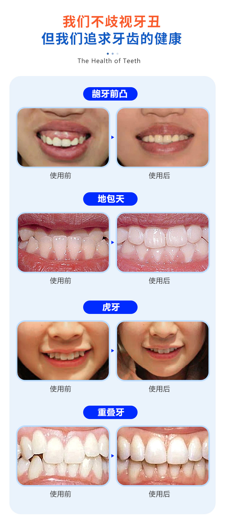 防止打鼾护齿牙套 EVA热塑防磨牙牙托+收纳牙盒套装【现货批发】-阿里巴巴