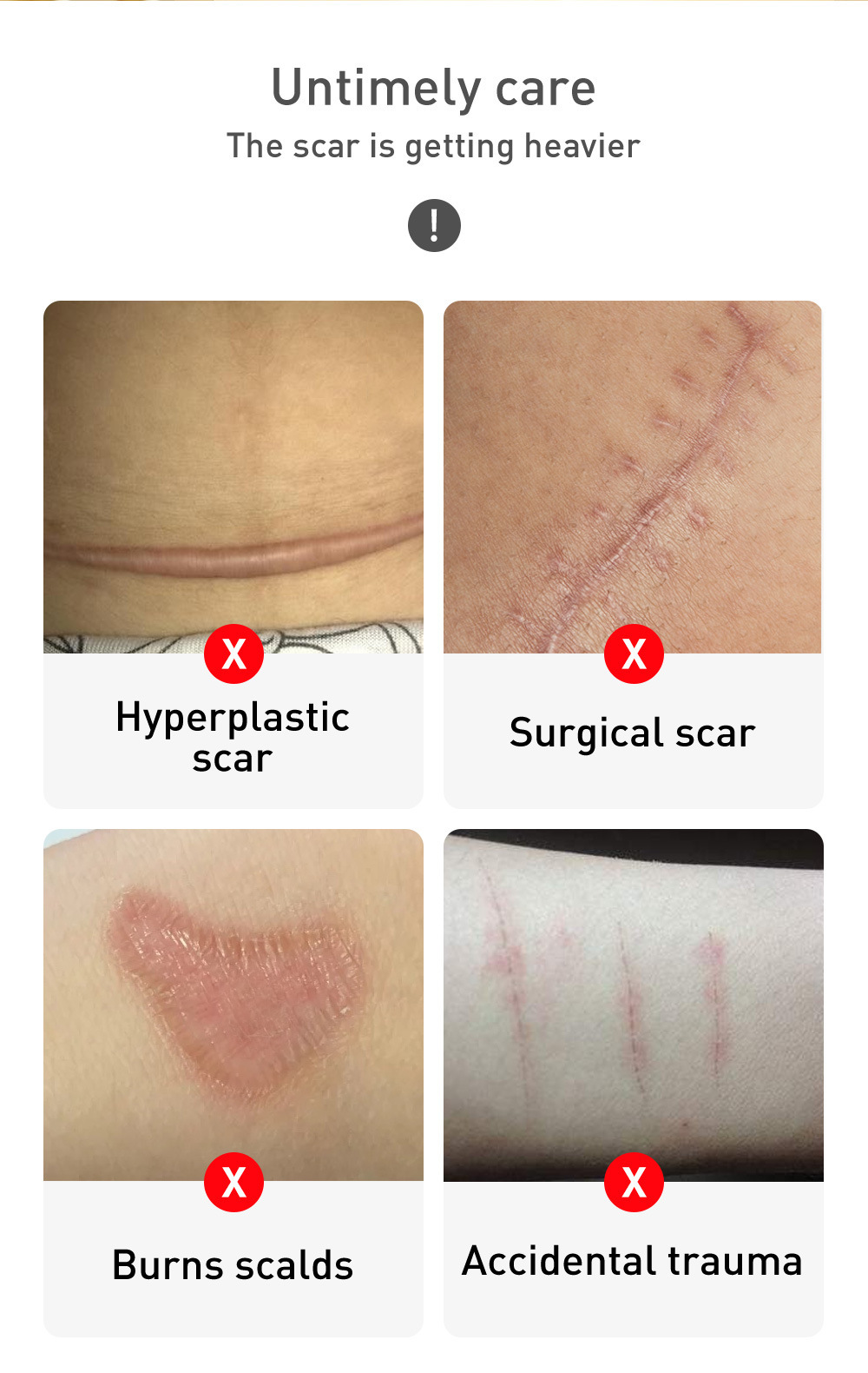 蓝蓓娜LANBENA TCM SCAR AND ACNE MARK REMOVAL GEL LB6221-阿里巴巴