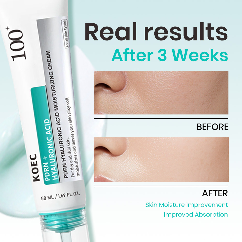KOEC透明质酸100+PDRN深层保湿面霜50g跨境亚马逊tk爆款HA保湿霜-阿里巴巴