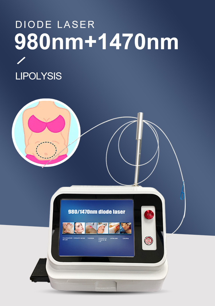 1470nm Portable Endolifting Laser Machine with 200um Optic F-阿里巴巴