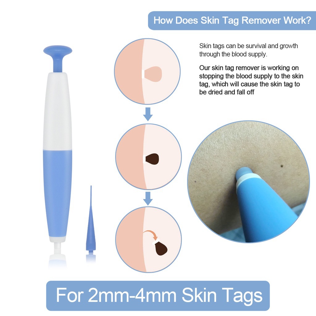 Skin Tag Removal Tool 祛皮赘笔祛肉痣祛鸡眼祛疣器 可配修复贴-阿里巴巴