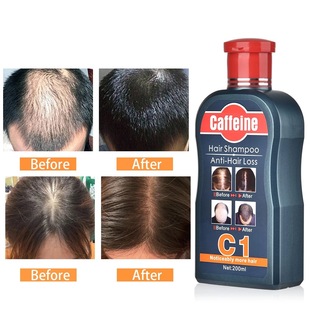 Caffeine Shampoo Slow Down Hair Loss Stimulate Hair Growth-阿里巴巴