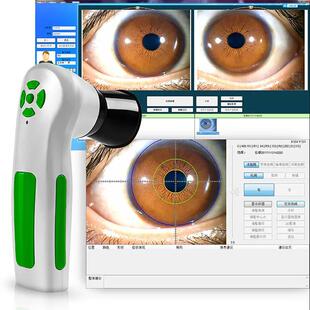 Medical Iridoscope Camera, Iris Analyzer + USB Iridoscope-阿里巴巴