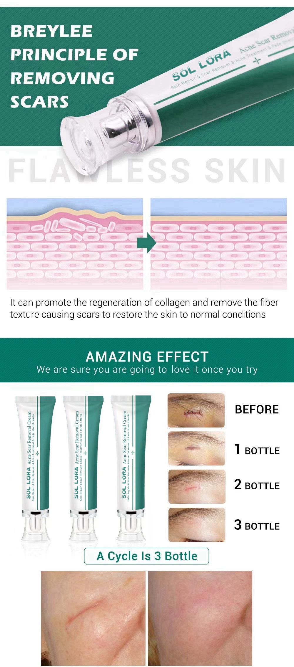 SOL LORA 速卖通亚马逊疤痕修护膏剖腹产伤淡化祛痘疤-阿里巴巴