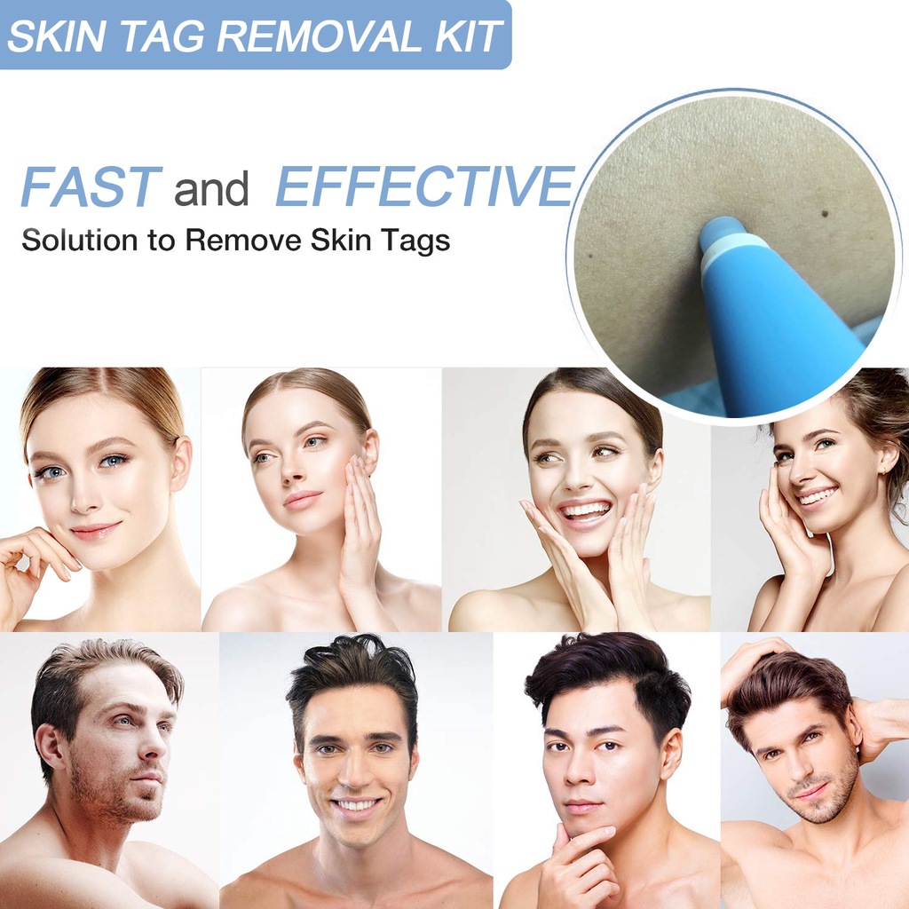 Skin Tag Removal Tool 祛皮赘笔祛肉痣祛鸡眼祛疣器 可配修复贴-阿里巴巴