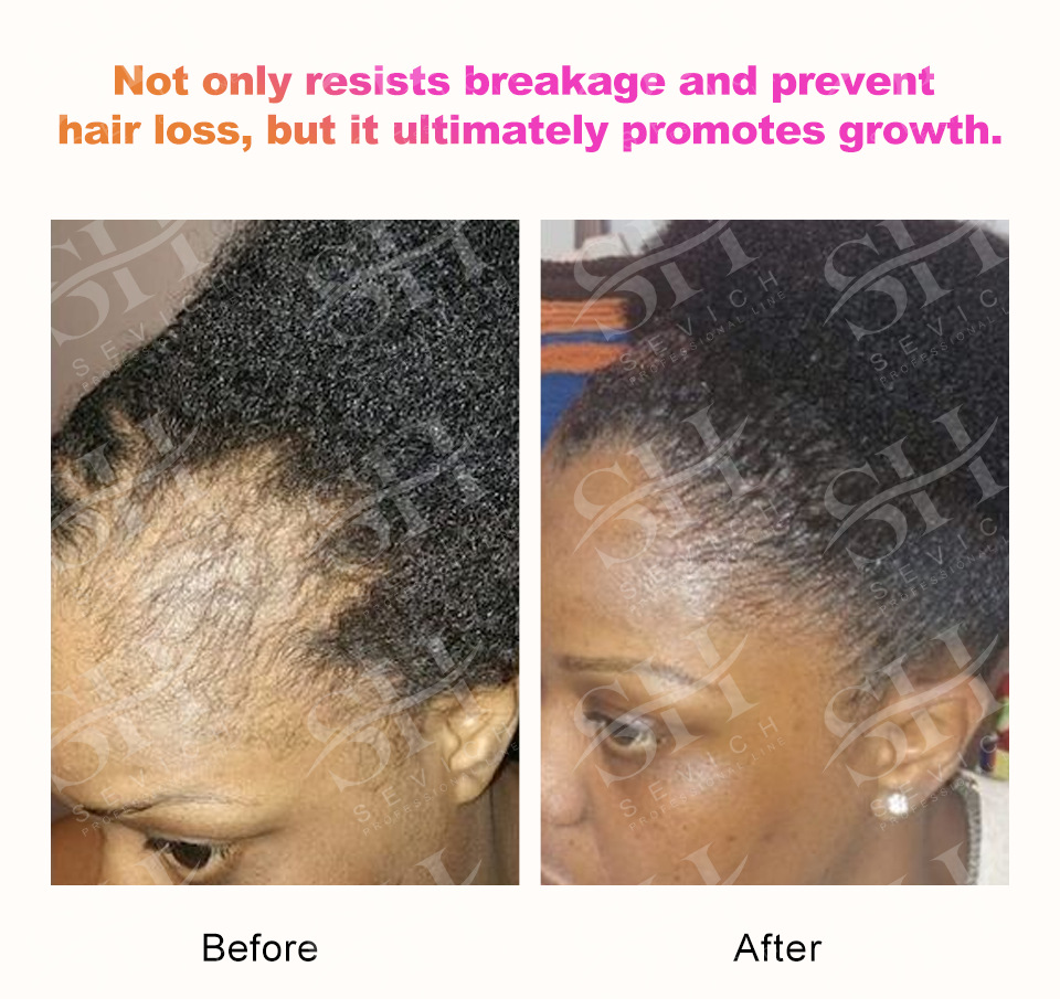 chebe护发精油有效减少头发断裂防掉发洗护组合非洲chebe护发系列-阿里巴巴