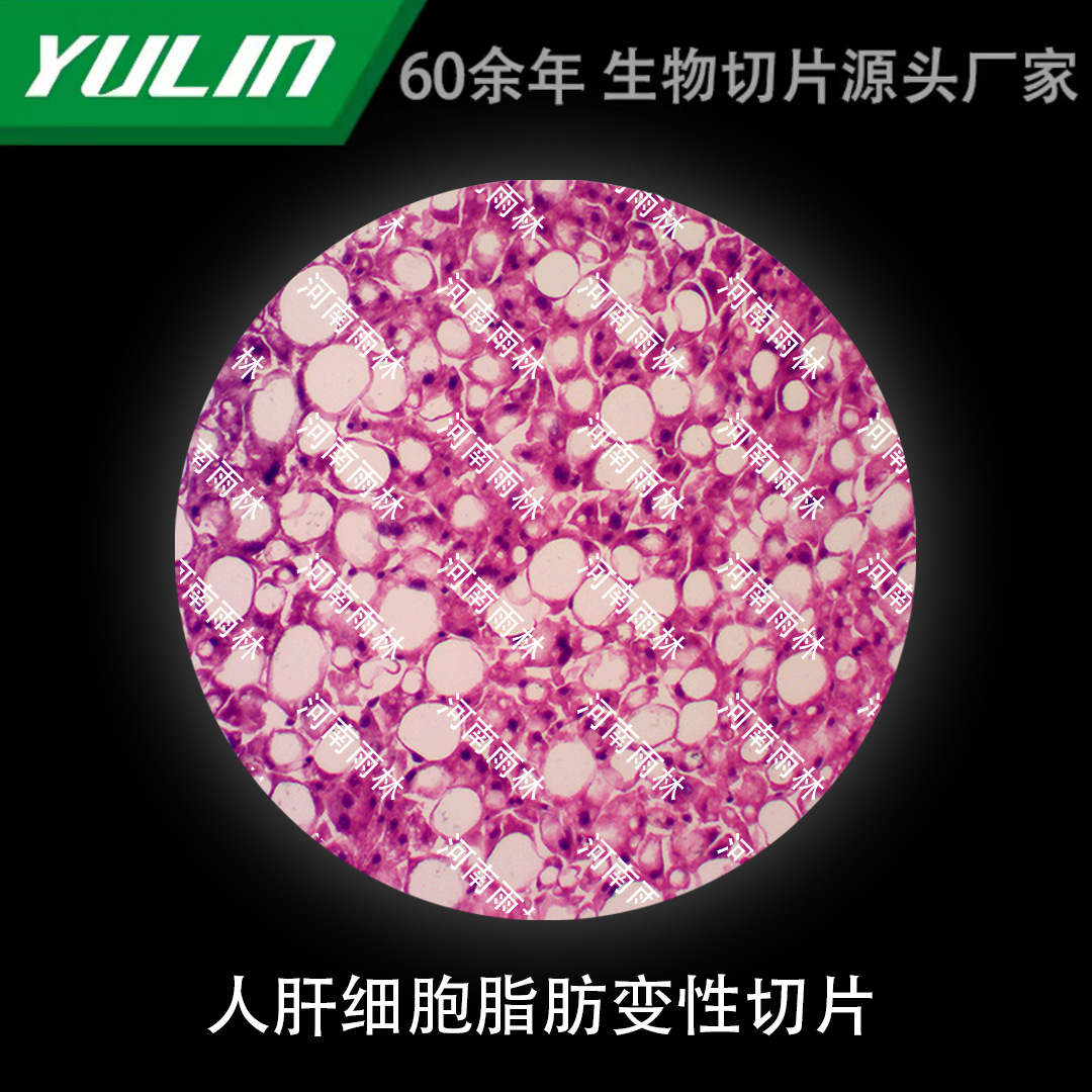 Human Liver Cell Fat Transgender Slice Biological Microscope Specimen ...