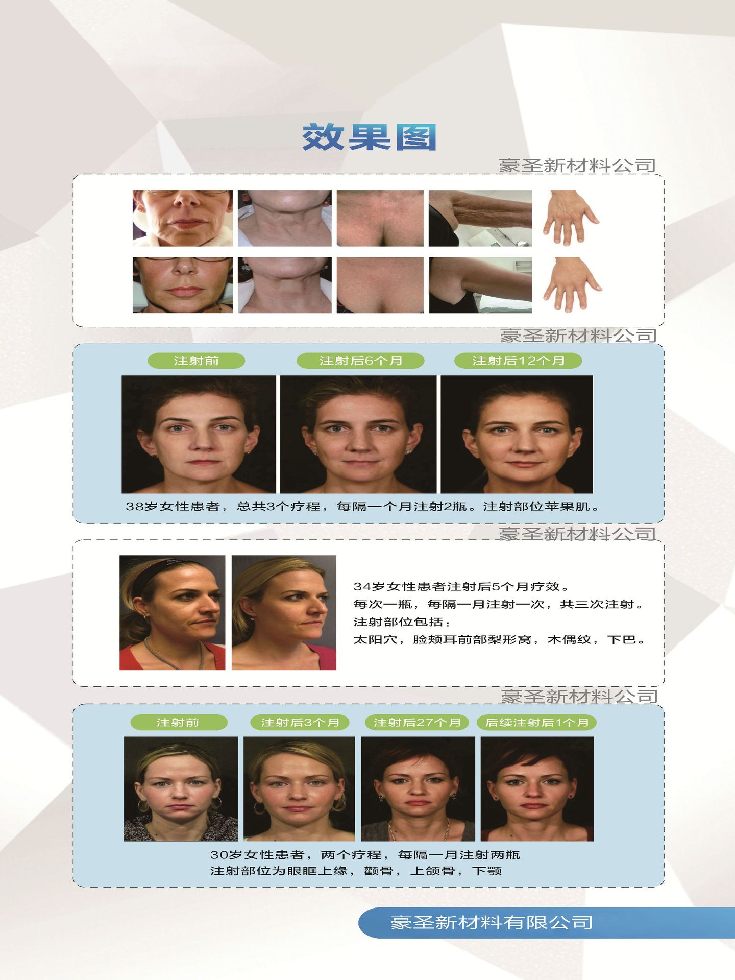 PLLA微球 PLLA左旋聚乳酸 医用填充 科研实验 可注射350毫克起订-阿里巴巴