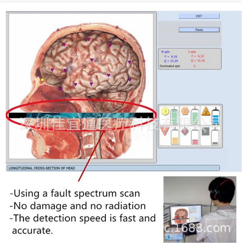 JYTOP 9DMRA/NLS 健康管理系统一体机9D头盔款-阿里巴巴