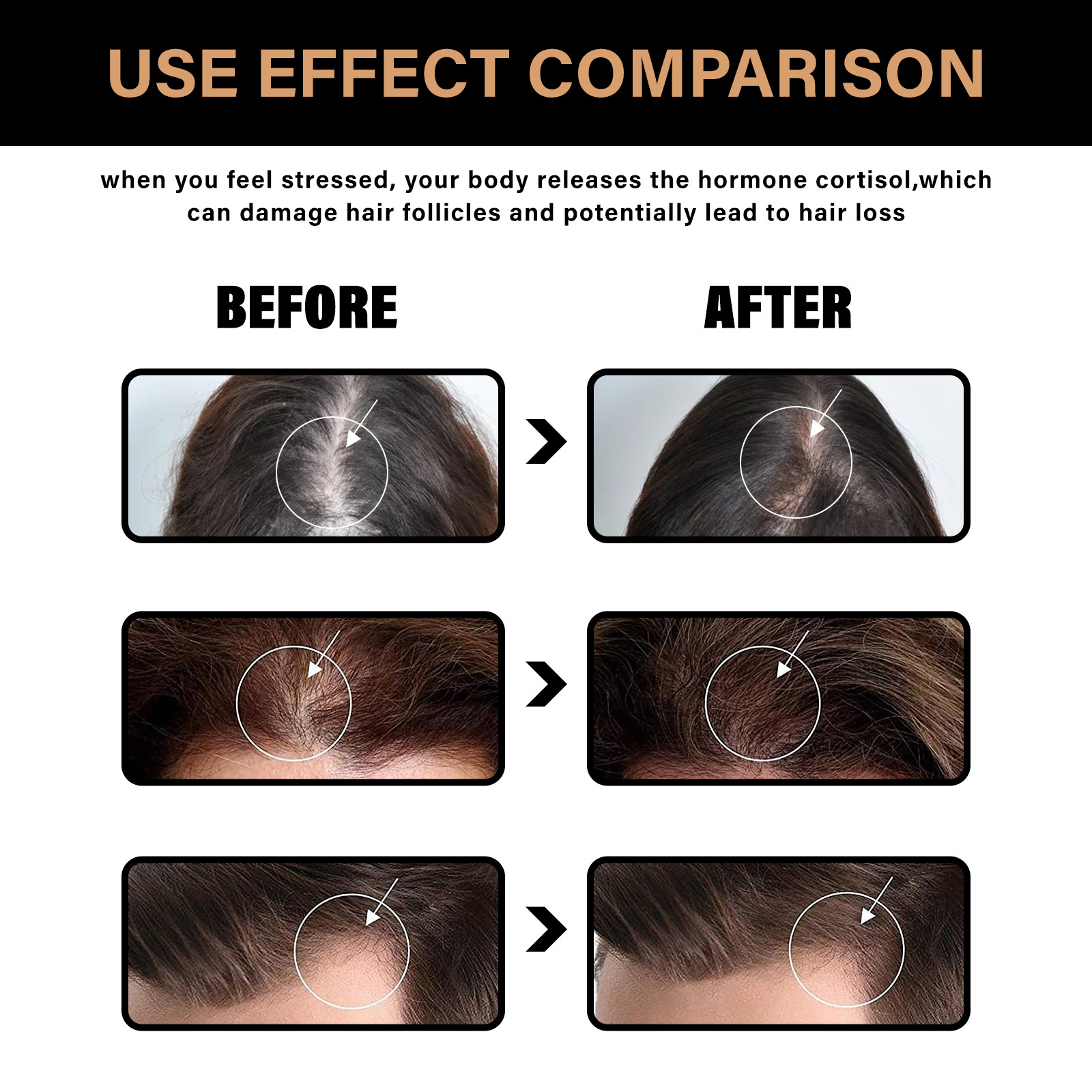 LUNOON浓密秀发洗发水滋养发根防掉固发浓密柔顺强韧修护发洗发露-阿里巴巴