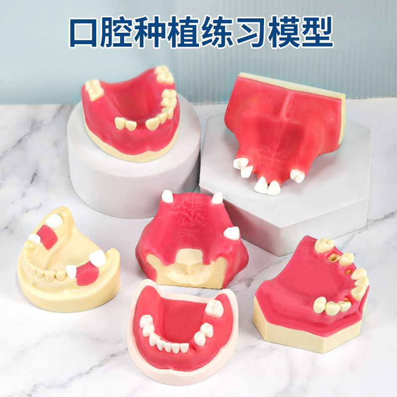 Oral Implant Practice Model Dental Implant Model Teaching Practical ...