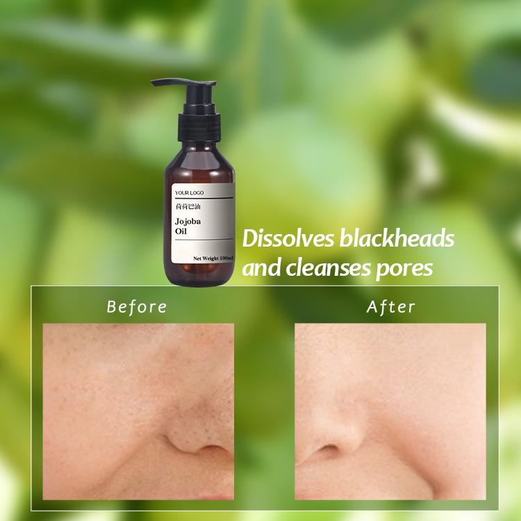 5KG有机USDA荷荷巴油Jojoba Oil霍霍巴籽油天然初榨冷压荷荷巴油-阿里巴巴