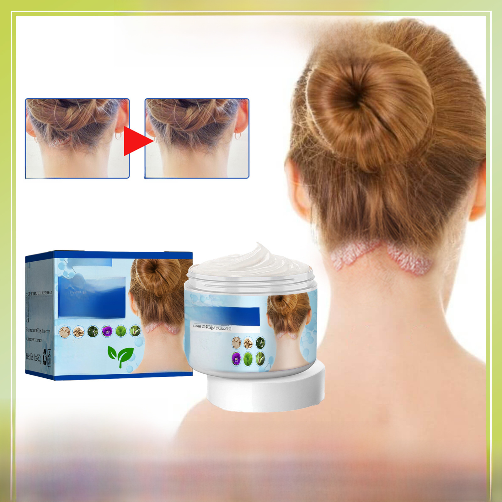 South moon seborrheic skin cream head acne itching tinea capitis skin ...