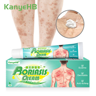 KanyeHB 癣膏 皮肤外用乳膏藓膏 Psoriasis Cream 跨境外贸速卖通-阿里巴巴