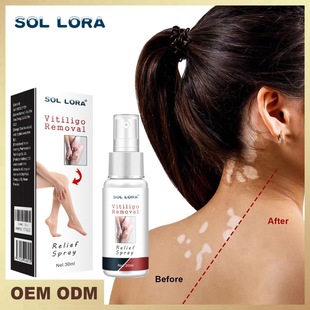 SOL LORA 跨境白斑净喷雾补骨脂白斑净喷雾皮肤修护花斑液护理-阿里巴巴
