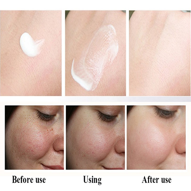 跨境现货 AnYi Beauty Magic Cream 30ml 速卖通 亚马逊 护肤品-阿里巴巴