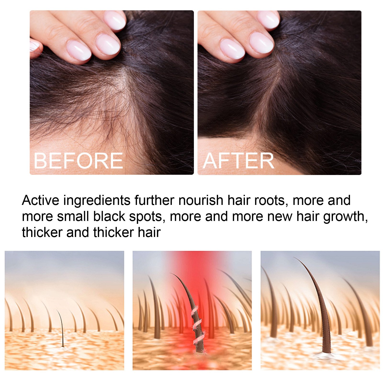 Growth Ginger essence Nourishing Hair Root Care Toughness Repair spray ...