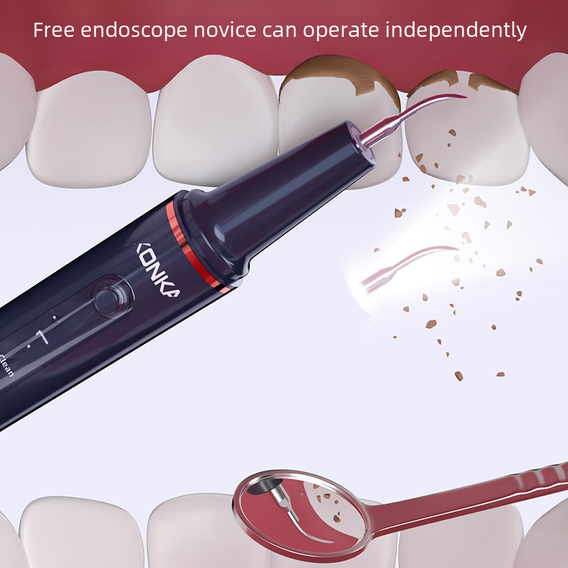 Konka ultrasonic frequency wave tooth cleaner tooth stone remover tooth ...