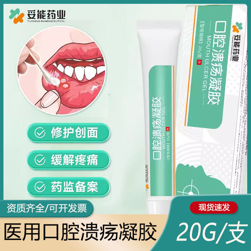 Tuo Neng Pharmaceutical Oral Ulcer Gel Paste Adult Aphthous Ointment ...