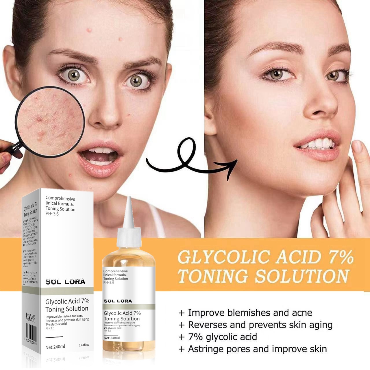 SOL LORA乙醇酸7%爽肤水祛痘淡化痘印闭口粉刺皮肤滋润嫩肤化妆水-阿里巴巴