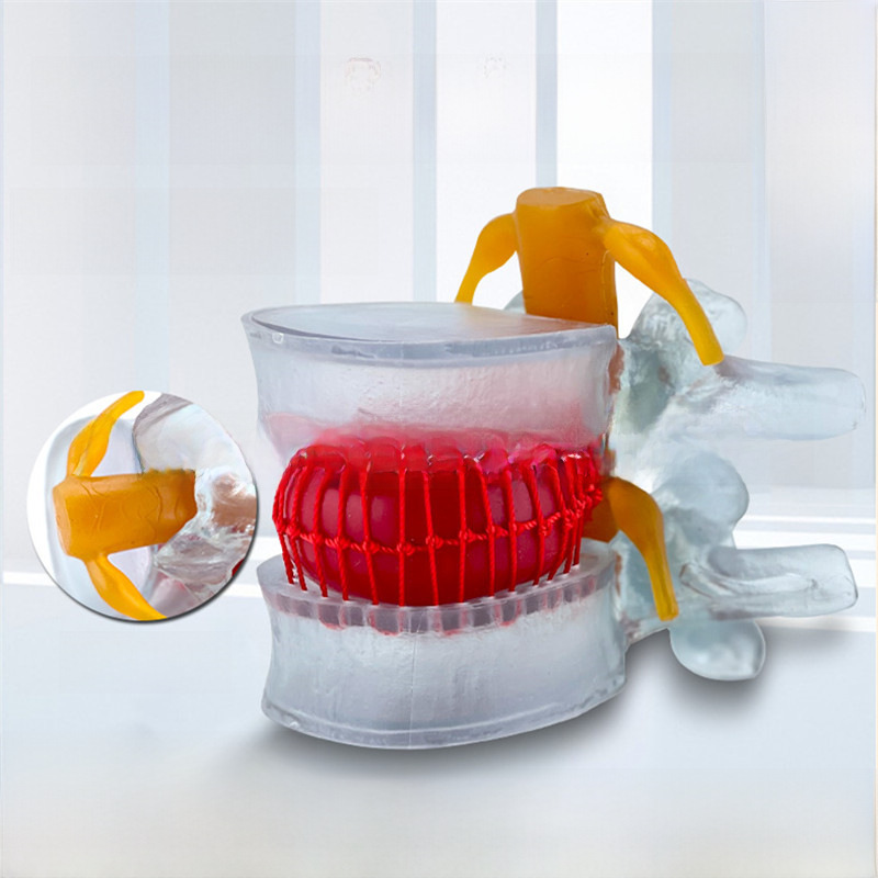 Human spine model Vertebral bone Lumbar disc mold Vertebral body model ...