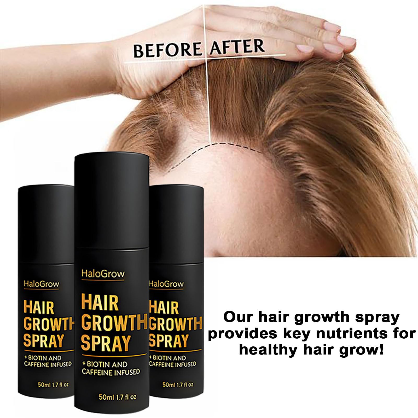 HaloGrow Hair Growth Spray,HaloGrow 头发喷雾-阿里巴巴