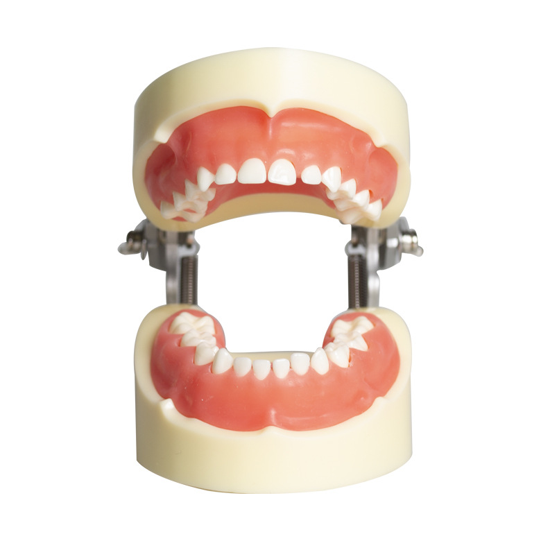 Dental Implant Model Dental Teeth Model – Ortho Implant Practice ...