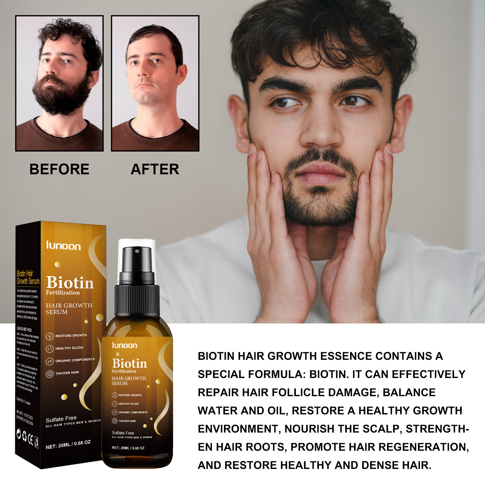 LUNOON生物素头发增长喷雾固发强韧防掉发按摩头护理生长营养精华-阿里巴巴