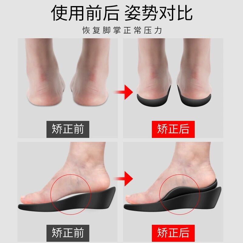 扁平足矫正鞋垫足内翻外翻半码垫xo型腿足弓鞋垫半垫后跟垫厂家-阿里巴巴